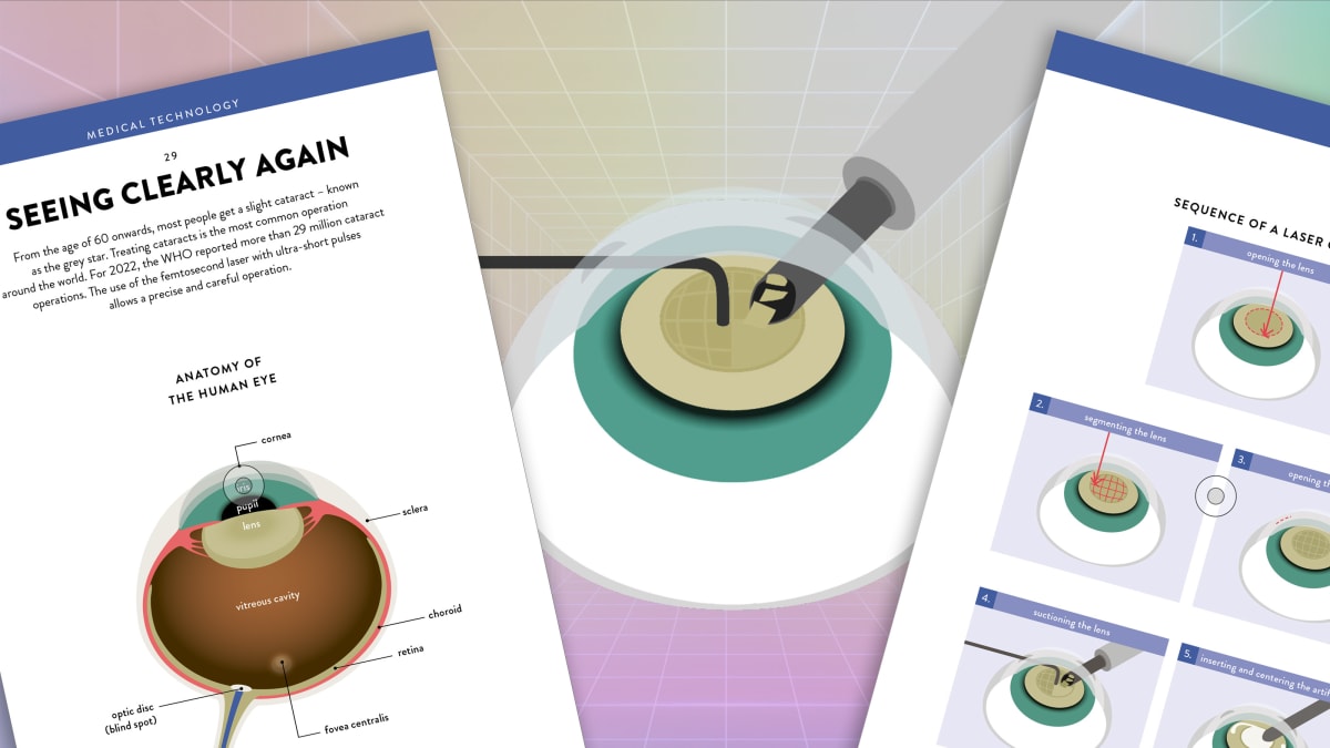 Seeing clearly again — SPECTARIS